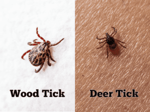 7 Easy Ways to Keep Ticks Away From Your Campsite